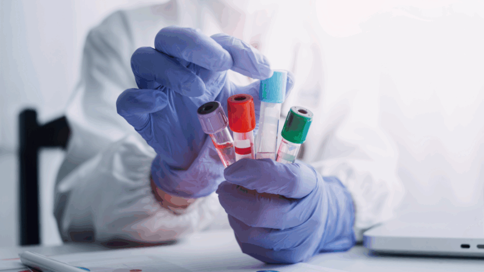 Unmasking Laboratory Testing - Healthcare Fraud Shield